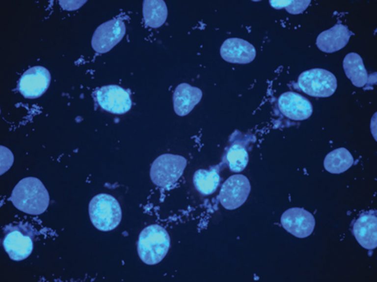 Role of Liquid handling instruments in Stem Cell Research ...